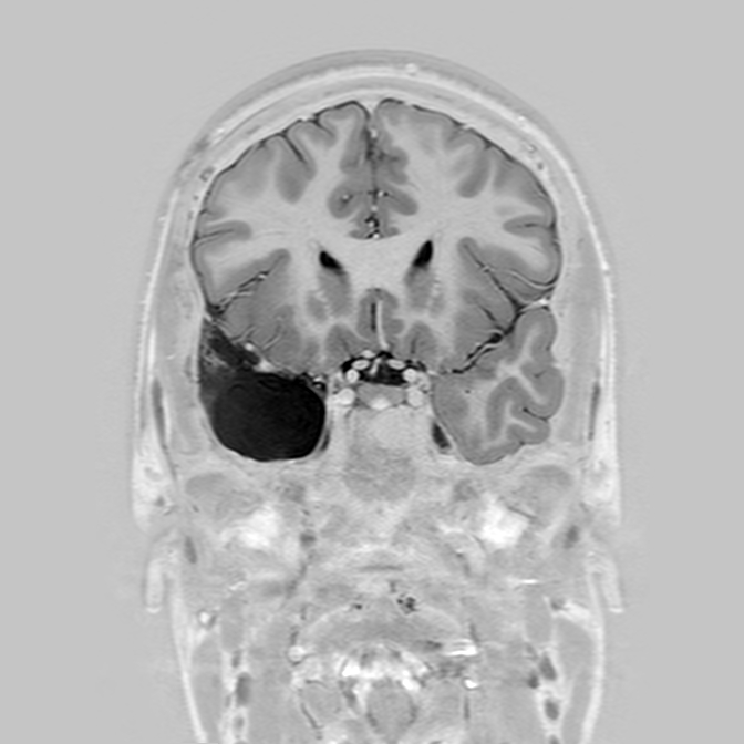 Ik en mijn epilepsie