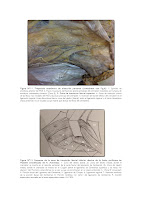 Cuadernos de Anatomía Quirúrgica: Anatomía quirúrgica del cremáster.