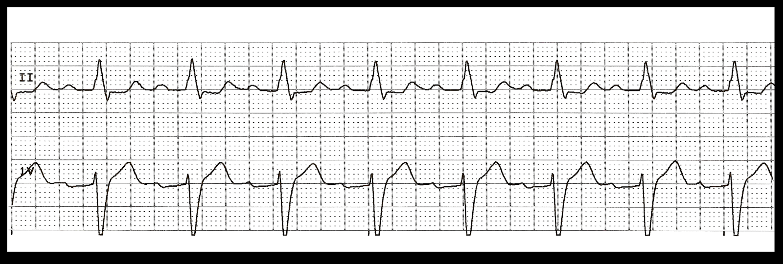 Practice Rhythm Strips 281