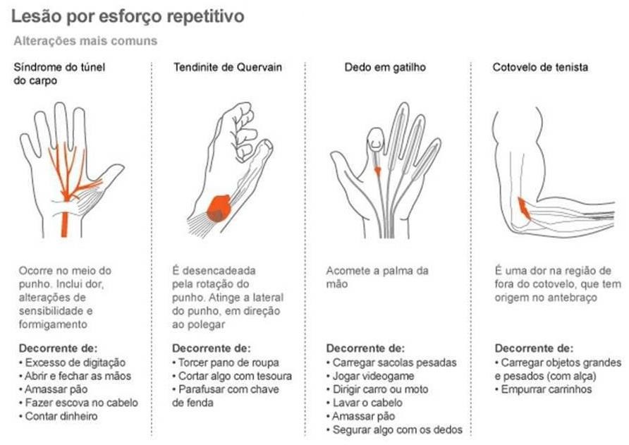 Osteopatia - O corpo como um todo...: Lesão por esforço repetitivo (LER ...