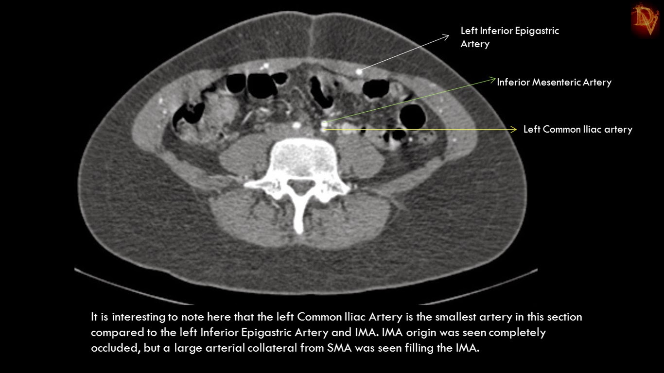 Ultimate Radiology : March 2015