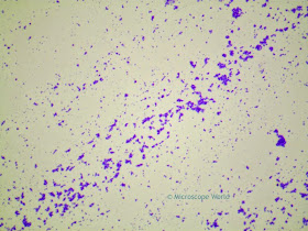 Microscope World Blog: Sarcina under the Microscope