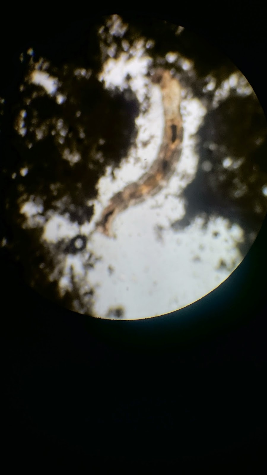 Biología Aplicada 4ºA -3- 2014: INFUSORIOS: FAUNA Y FLORA DE UN CHARCO.