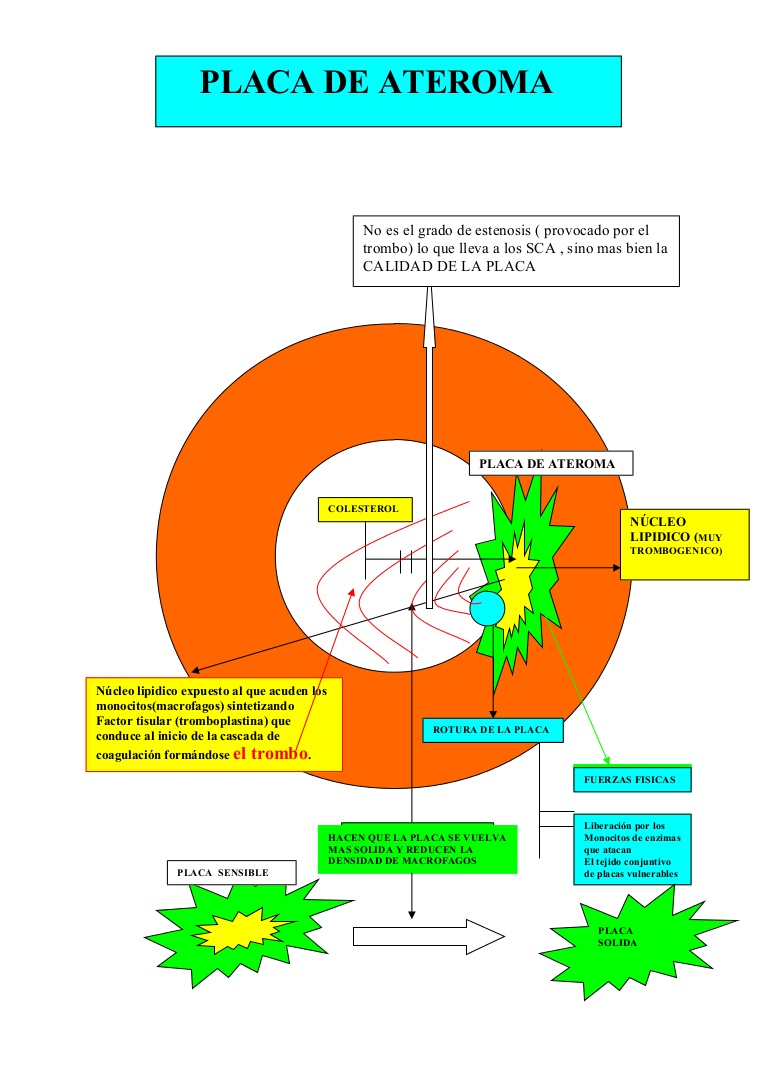 placa de ateroma - wood scribd braxin