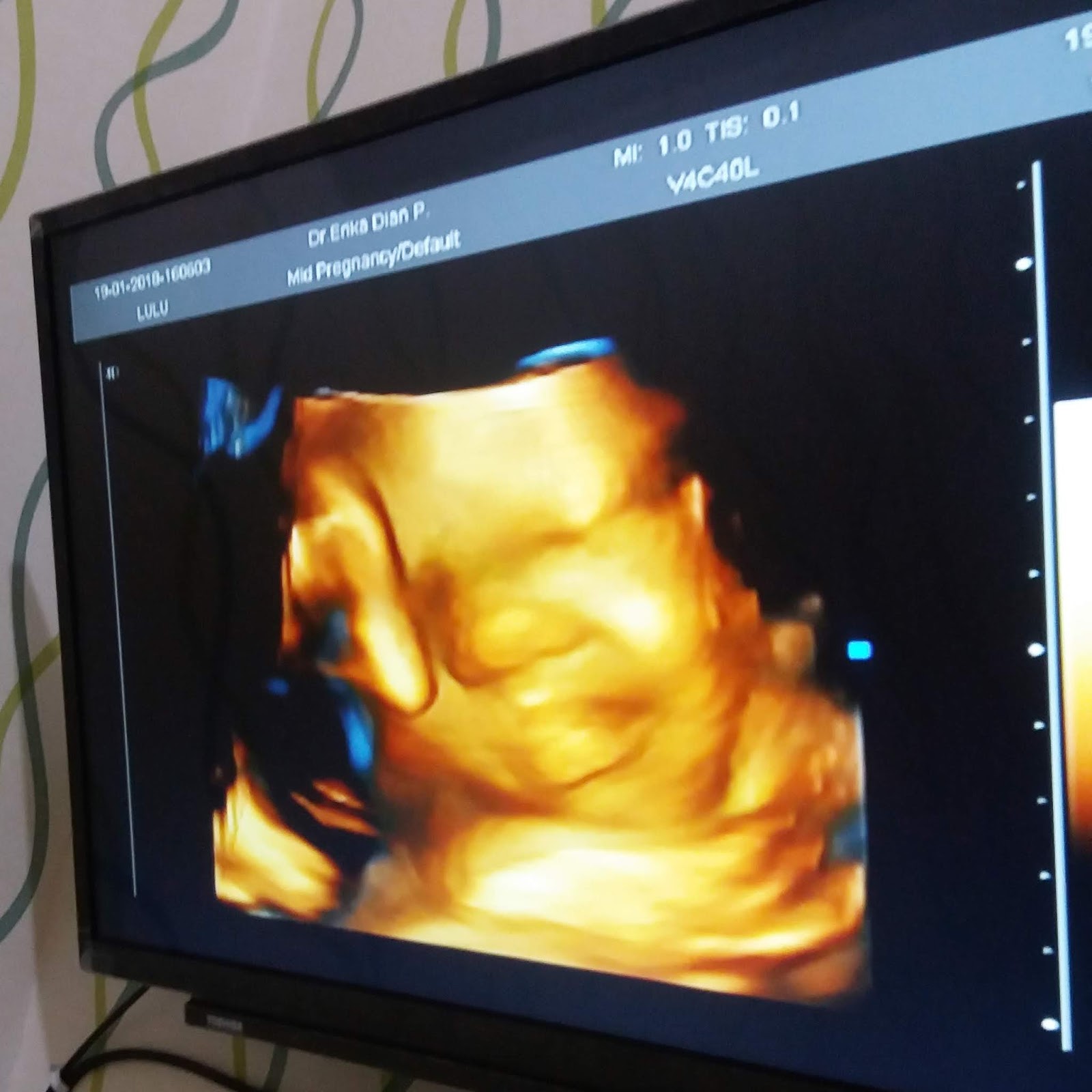 lulululicious: USG 4D MURAH DI SEMARANG