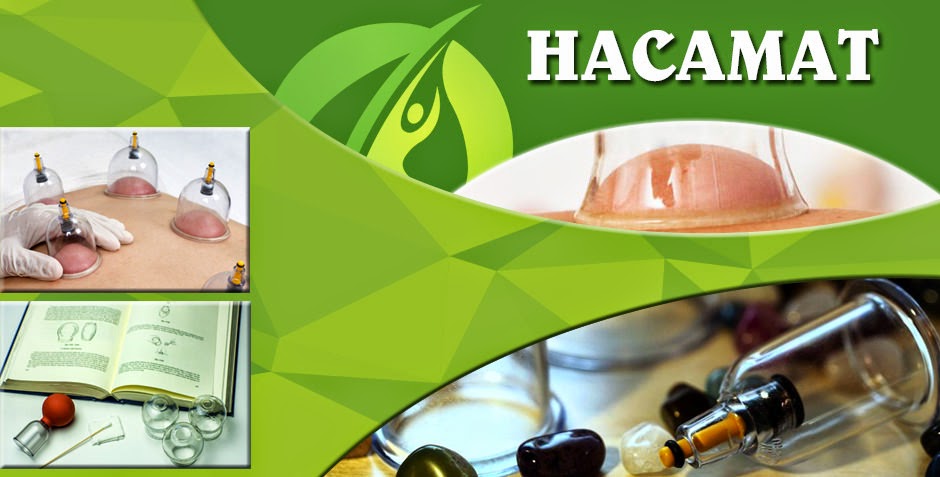 Hacamat tedavisi