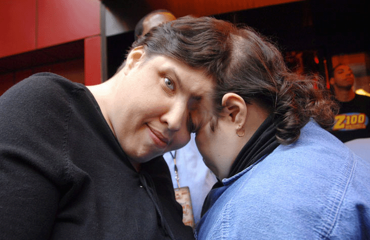 World's oldest-living conjoined twins turn 50