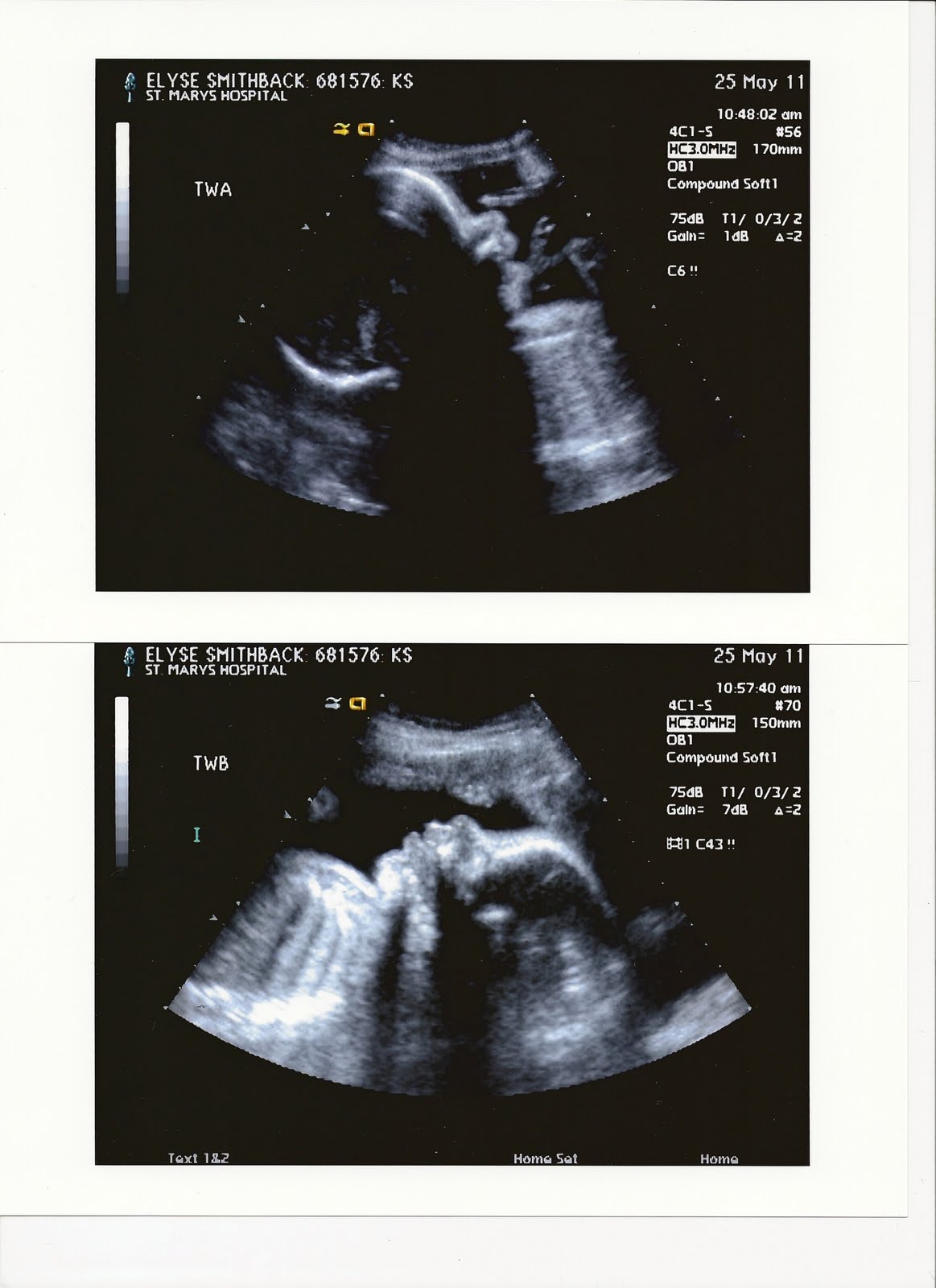 Smithback Twins: 32 Week Ultrasound & Nursery!