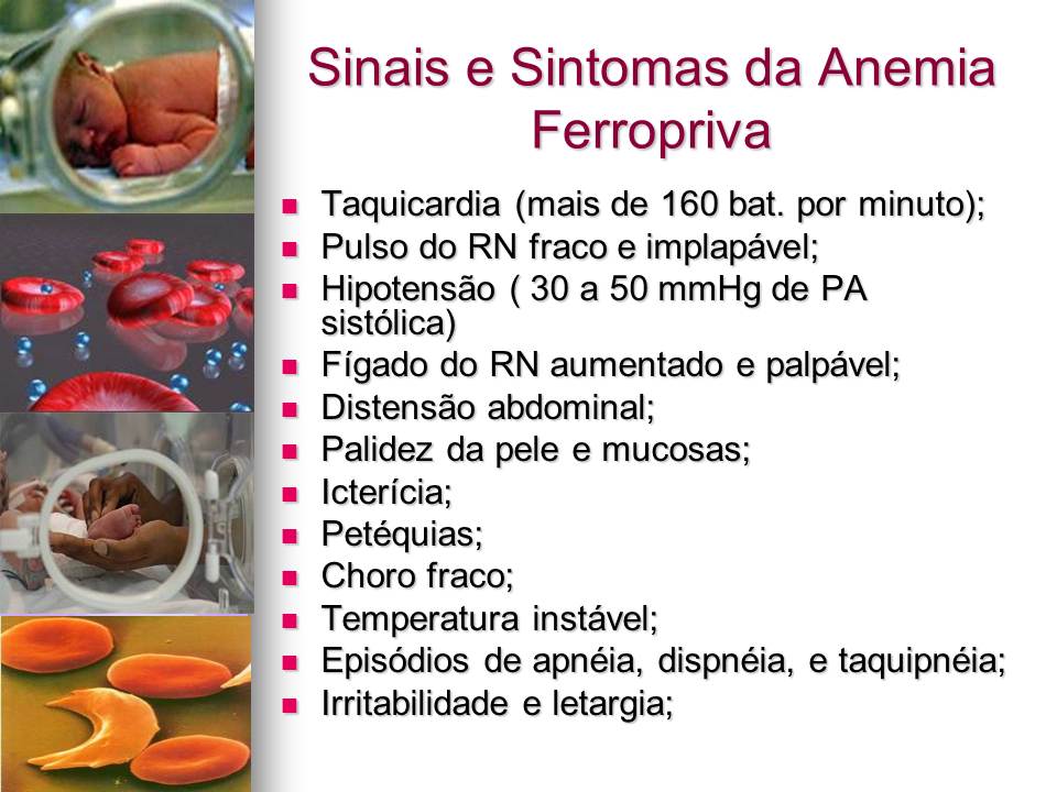 Enfermagem, aprendendo, realizando e ensinando o cuidado: Anemia Neonatal