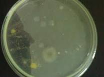 MEDICAL LABORATORY TECHNOLOGY: Inokulasi Bakteri