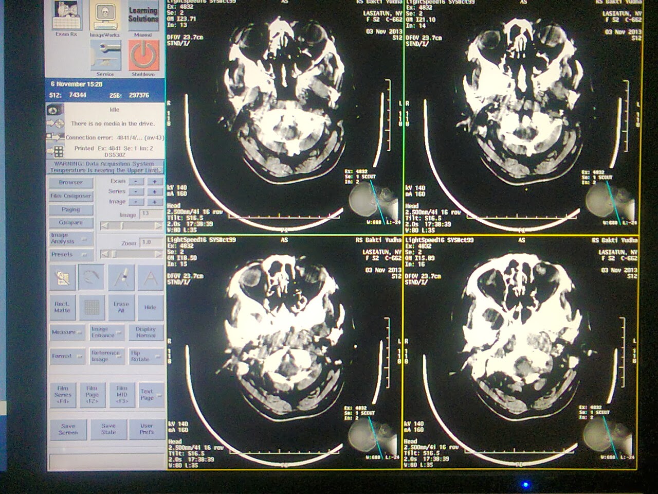 SiMpLe LoVe 'n LiVe: CT Scan (Computed Tomography Scanner)