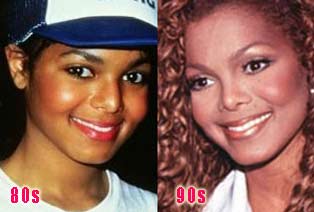 Janet Jackson Plastic Surgery Before and After Nose Job and Breast ...