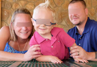 Klippel-Feil Syndrome Pictures | Medical Pictures and Images - (2023 ...