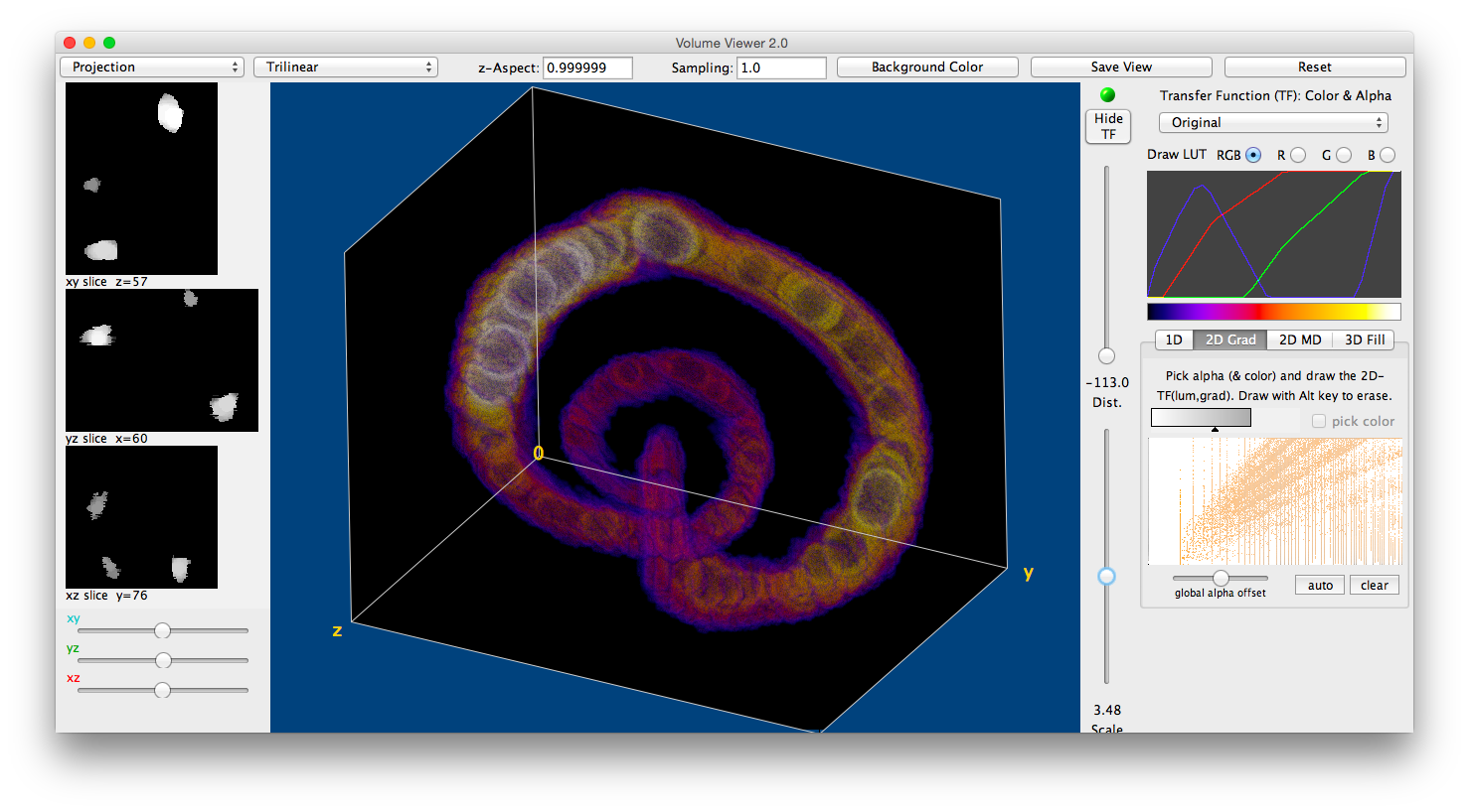 このカラーは、3D Local Thickness機能によっ て厚みのカラーマップを表しており、その数値としては平均 厚み、平均スペース距離が ...