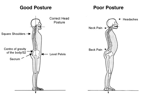 Promatx Health Club: Posture and Forward Head