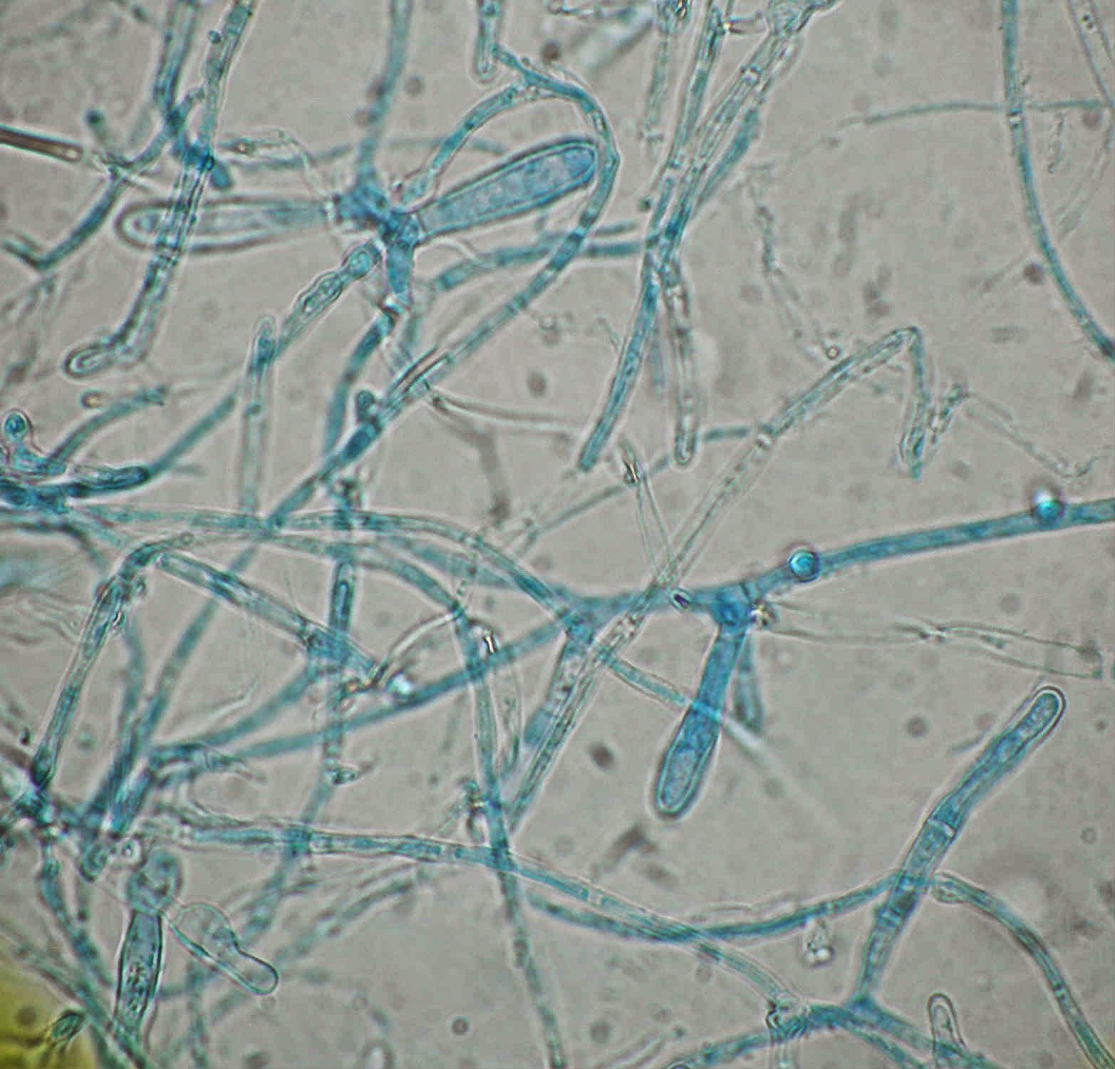 ATLAS MICOLOGIA: EPIDERMOPHYTON FLOCCOSUM