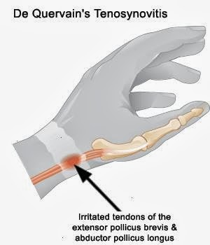 Fisioinforma: Diagnóstico Diferencial e tratamento de um paciente com ...