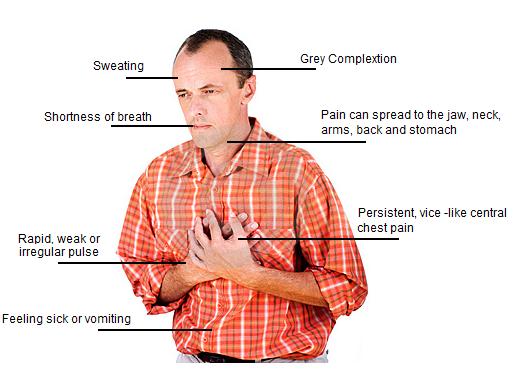 7 Symptoms of heart attack problem for men
