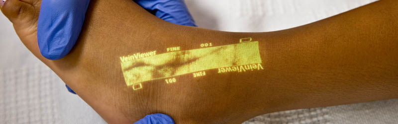 allaboutmedisci: VeinViewer