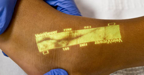 allaboutmedisci: VeinViewer