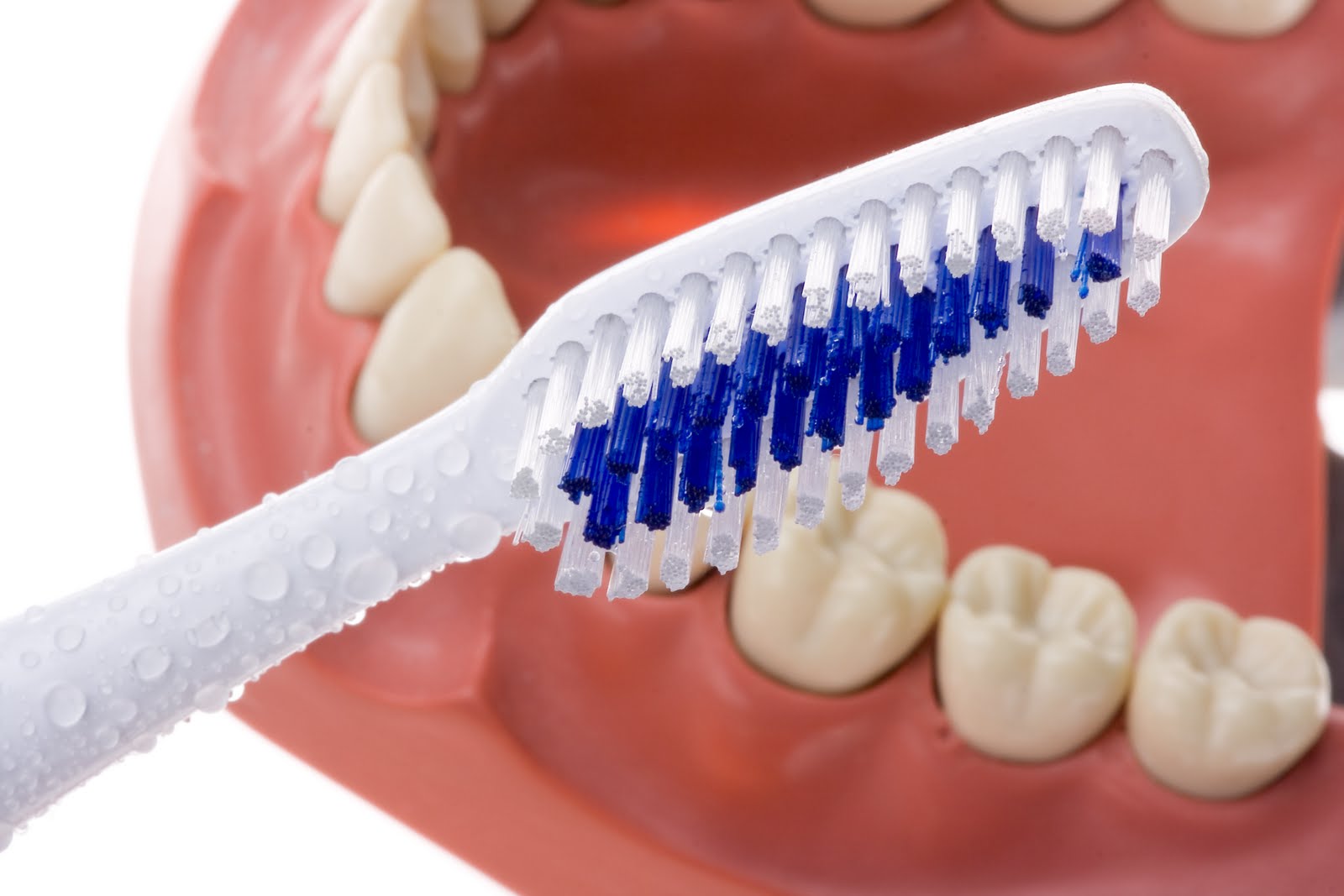 Dientes Lindos y Sanos Dra. Doraly Cruz: La Placa Dental ¿Sucio?