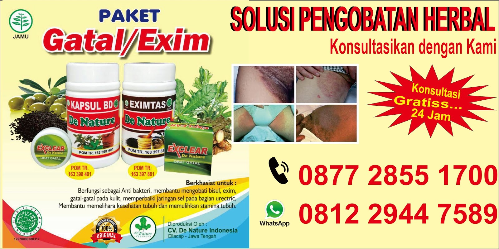 jenis obat salep untuk gatal pada kulit selangkangan dan bokong