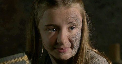 The Dermatology of Greyscale ~ Science Storiented