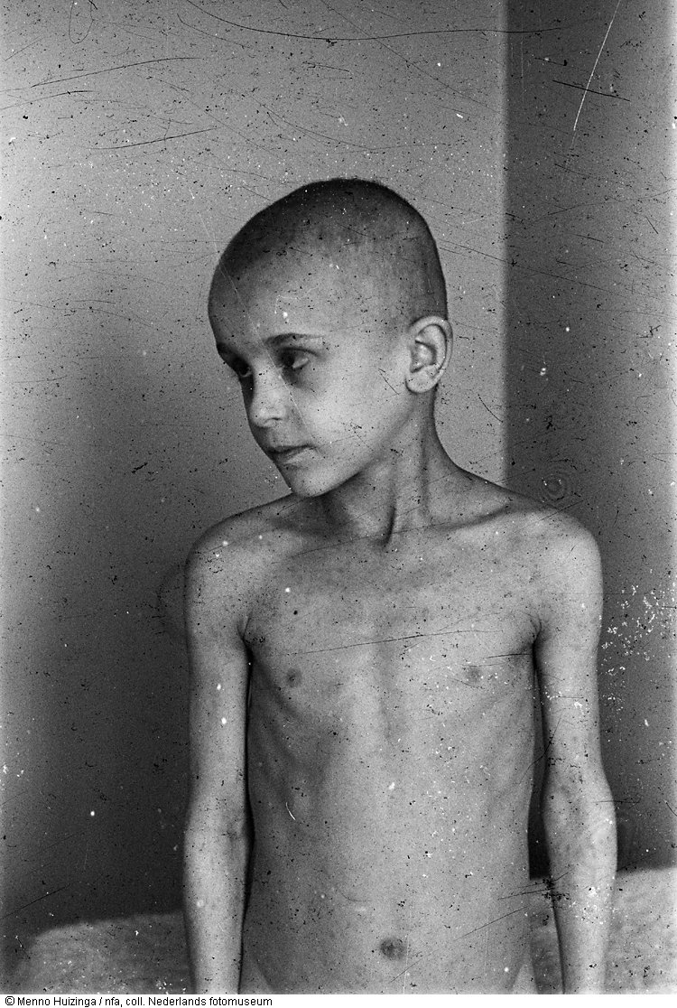 World 1900 - 1950: Dutch famine of 1944-1945 ( known as the Hongerwinter)