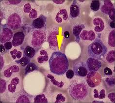 Trombosit (sel darah pembeku atau keping darah) | Pengertian ILMU