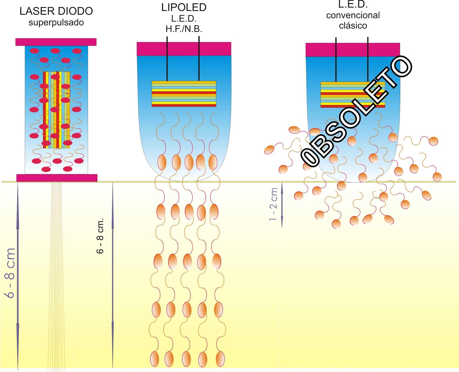 LIPOLED de MEDILUX, la luz como terapia
