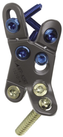 The Daily Fix: New Ascension Ankle Fusion Plate