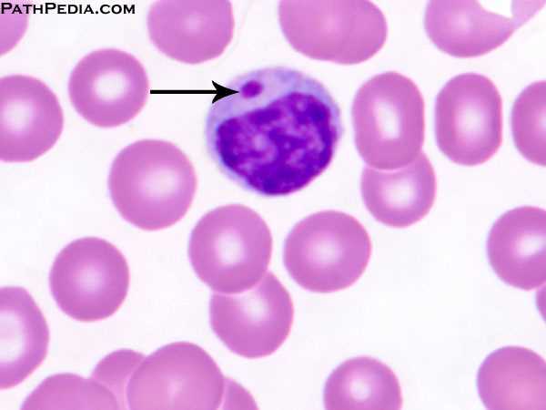 Lecture Notes in Medical Technology: Lecture #9 : The White Blood Cells