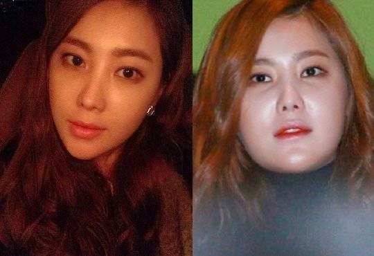 Seoul Beautiful: Part 1: Plastic Surgery
