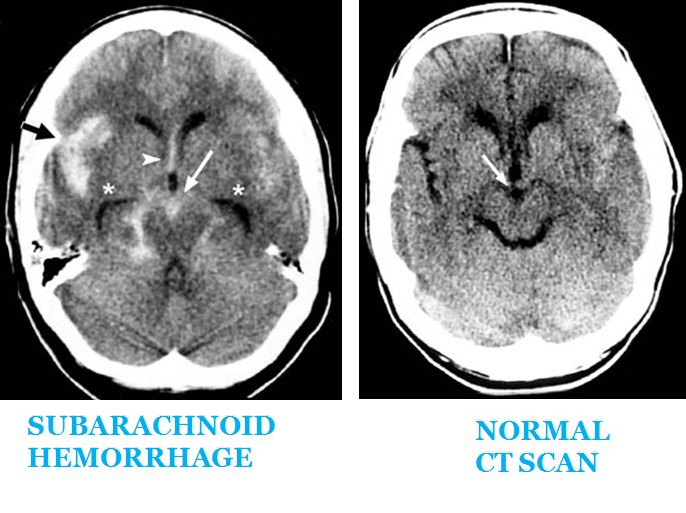 MBBS Medicine (Humanity First): May 2013
