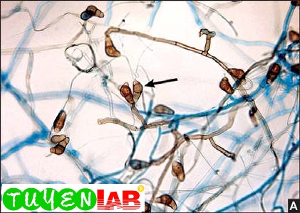 Macroscopic and Microscopic Characteristics of Ocular Fungal Isolates ...