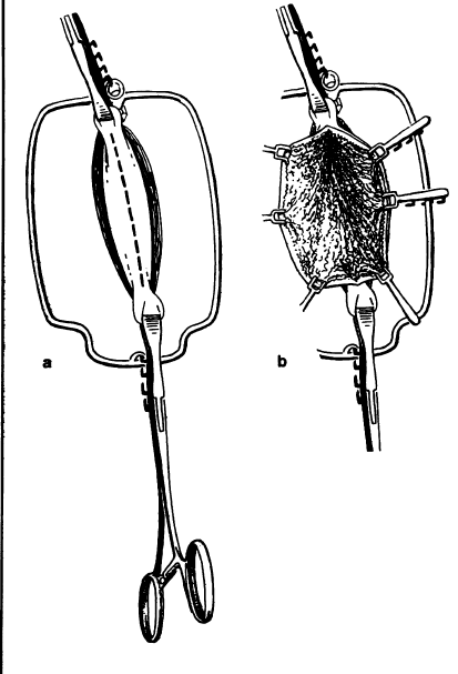 Teknik Operasi Gastrotomy & Rumenotomy pada Hewan (Bedah Digesti ...