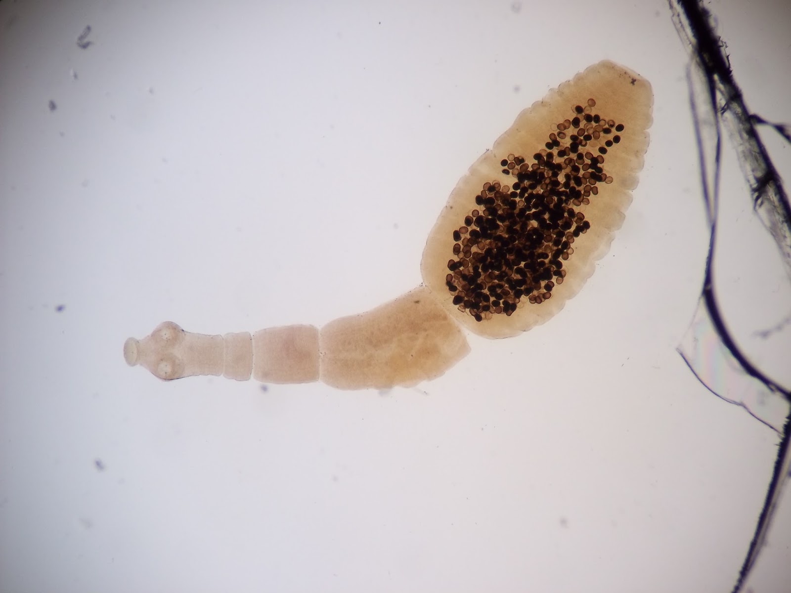 Lecture Notes in Medical Technology: Lecture #5: THE CESTODES OR TAPEWORMS