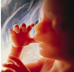 Problemas del niño y lactancia materna: Problemas de succión