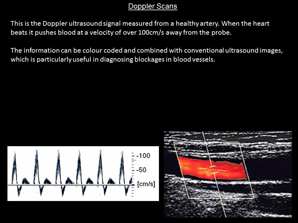 Mr Lloyd's Interactive Board: Doppler Effect, ultrasound, medical imaging
