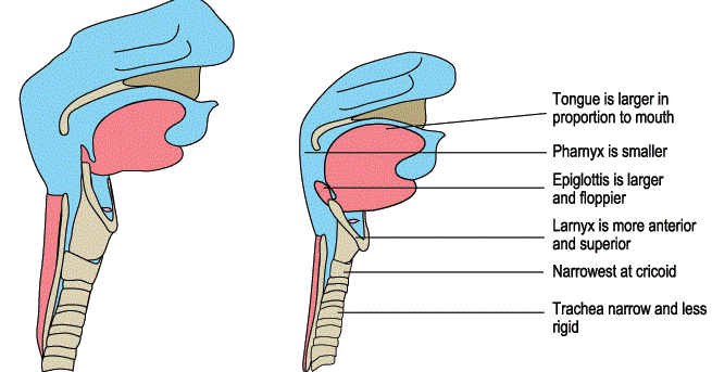 Prepare for Medical Exams : Airway In An Infant Compared to Adult/Older ...