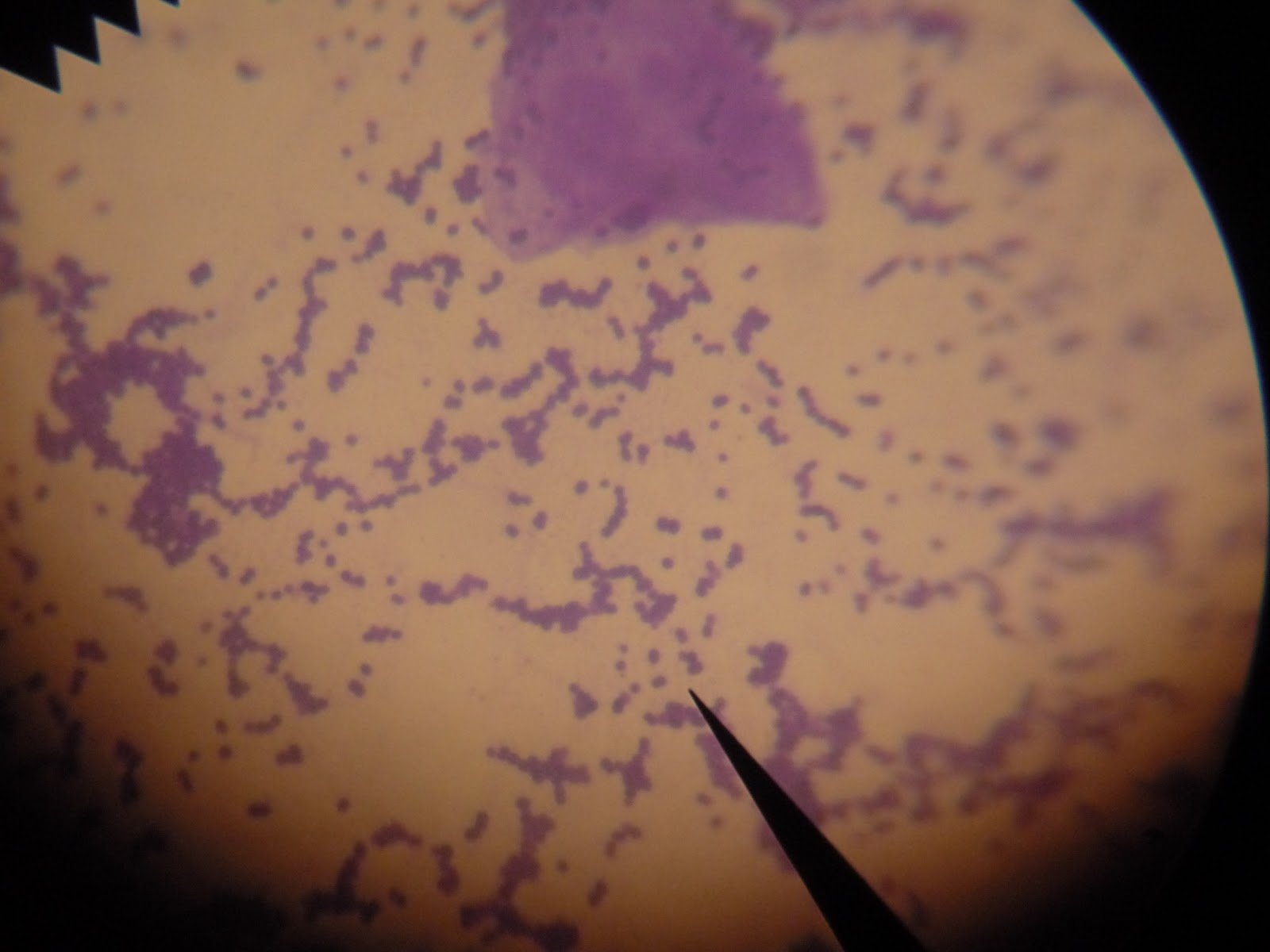 MicrobeDiscoveries: Simple Stain