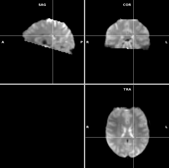 =Vision Group fMRI analysis guide=: Retinotopy analysis @ BrainVoyager