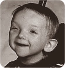 Medical Treatment Pictures-for Better Understanding: CHARGE Syndrome