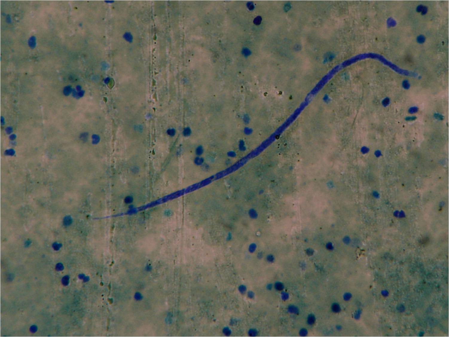 Loa Loa - JungleKey.fr Image