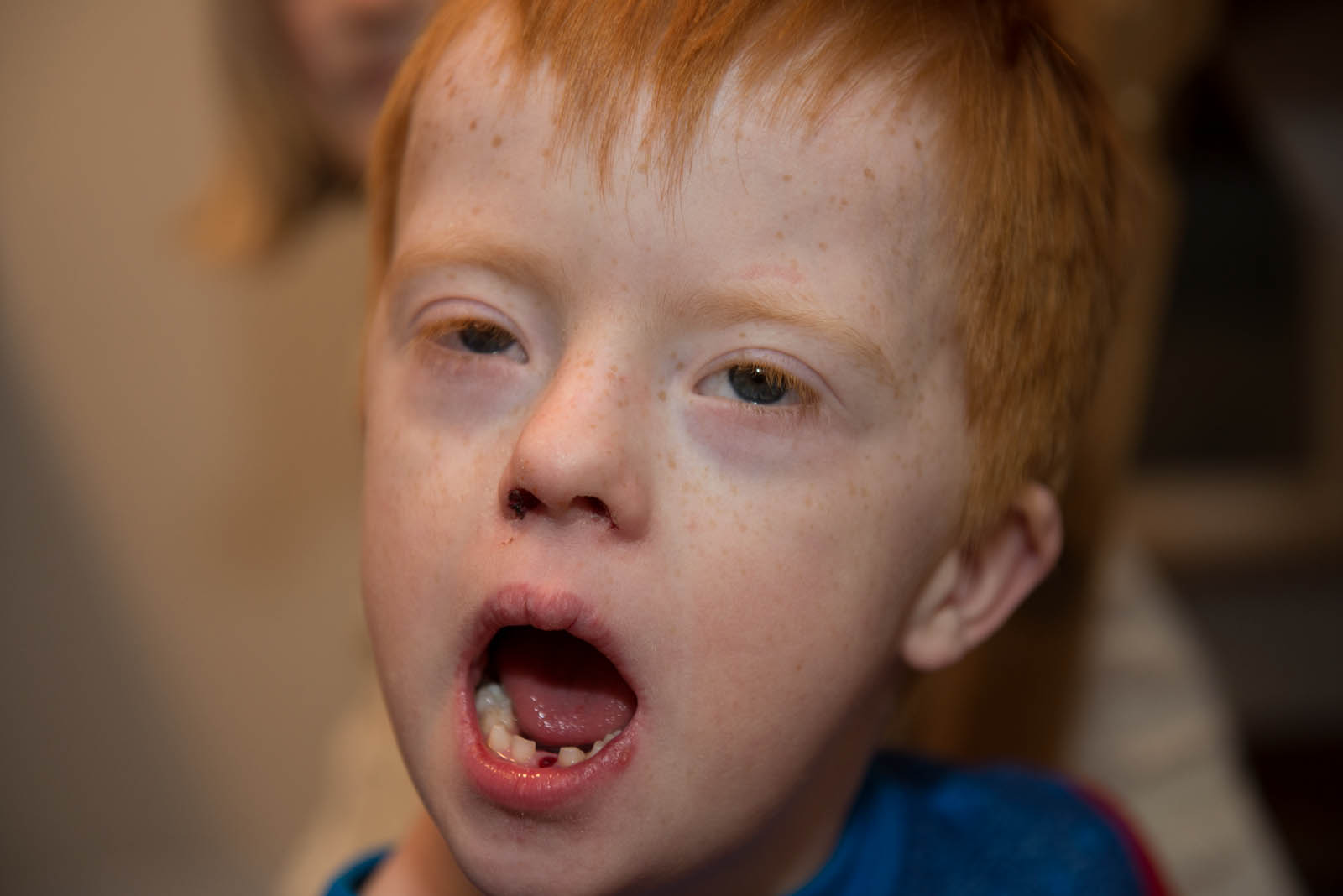 TASCSSS Gerritsen: Sam's first tooth out