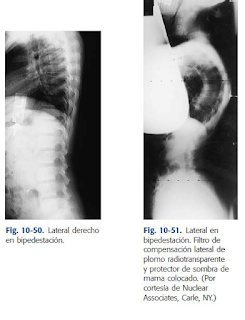 PRODUCCION Y TRATAMIENTO DE IMAGENES DIAGNOSTICAS: CAPITULO COLUMNA ...