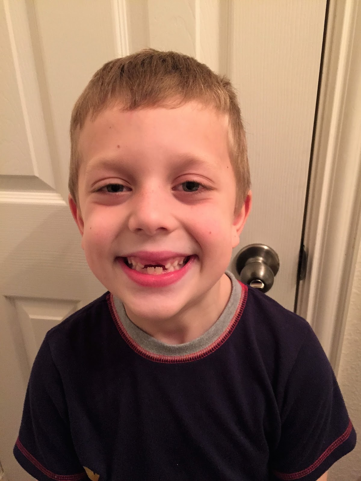 The Carpenters' Corner: Drew Lost Both His Front Teeth