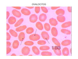 HEMATOLOGÍA : octubre 2018