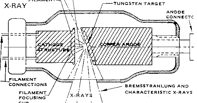 Sinar-X Dan Efek Radiasi Sinar-X Untuk Tubuh Manusia ~ Kashelara