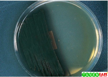 [Microbiology] Atlas of Streptococcus, Enterococcus, and Other Catalase ...